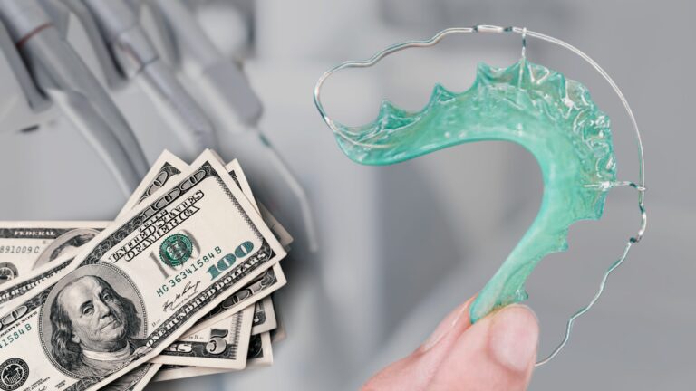 How Much Do Retainers Cost? Price Ranges You Should Know - North ...