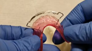 How Much Do Retainers Cost? Price Ranges You Should Know - North ...