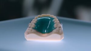 How Much Do Retainers Cost? Price Ranges You Should Know - North ...