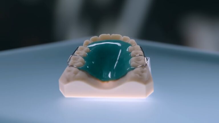 How Much Do Retainers Cost? Price Ranges You Should Know - North ...