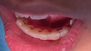 How Much Do Retainers Cost? Price Ranges You Should Know - North ...