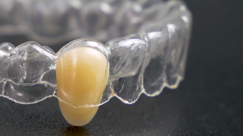 How Much Do Retainers Cost? Price Ranges You Should Know - North ...