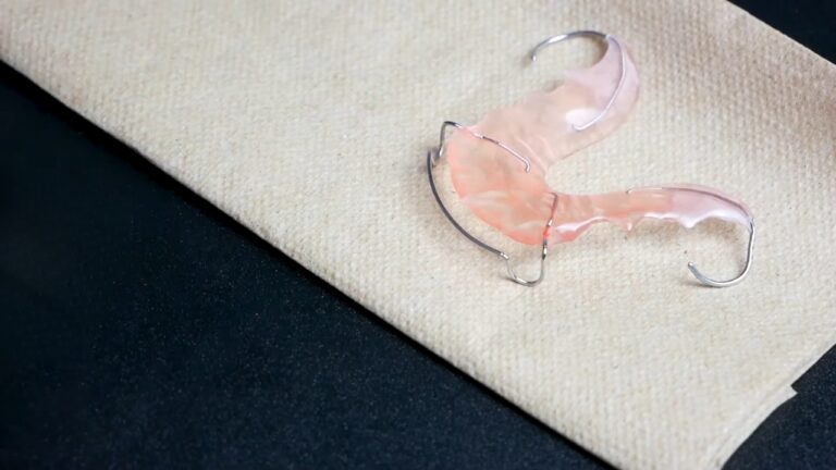 How Much Do Retainers Cost? Price Ranges You Should Know - North ...