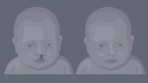 Most Common Birth Defects in the US. – Regional Data Breakdown - North ...