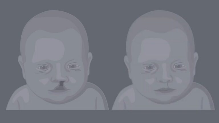 Most Common Birth Defects in the US. – Regional Data Breakdown - North ...