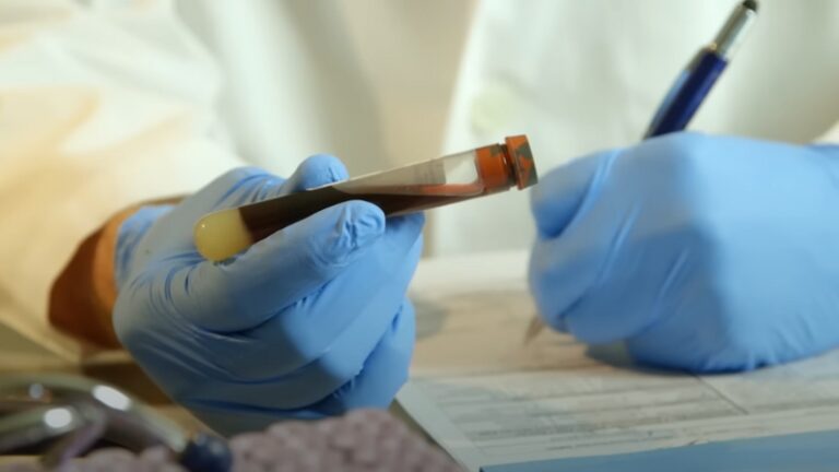 The Golden Blood Type (Rh Null) - Rarest Blood Group, Transfusion ...