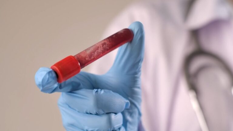 The Golden Blood Type (Rh Null) - Rarest Blood Group, Transfusion ...