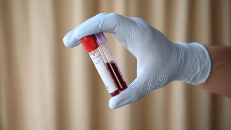 What Is The Most Common Blood Type In The United States? - North ...