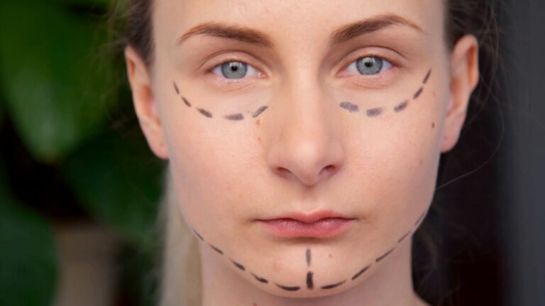 How Many People Got Plastic Surgery in the United States in 2025 ...